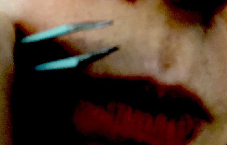 What Causes a Female Moustache? | myHIRSUTISM.com